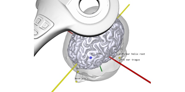 Neuronavigation for TMS