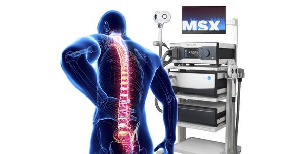 Andere genavigeerde rTMS toepassingen